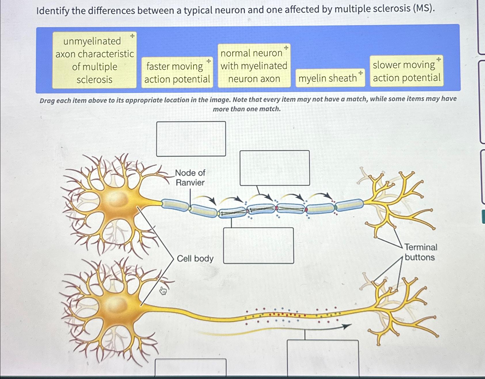 Solved Identify the differences between a typical neuron and | Chegg.com