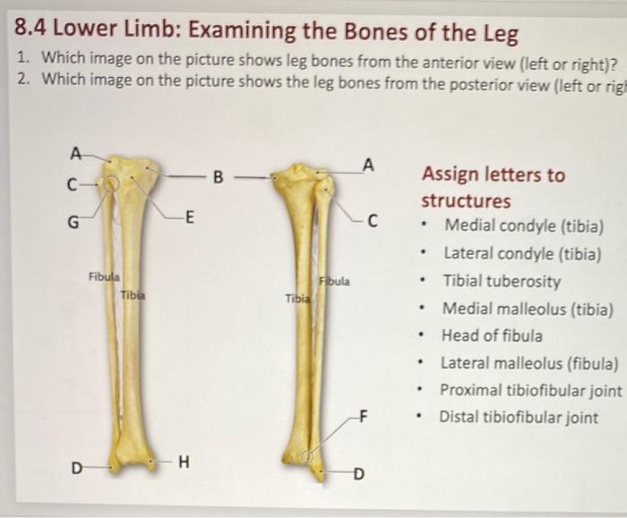 Solved 8.4 Lower Limb: Examining the Bones of the Leg 1. | Chegg.com
