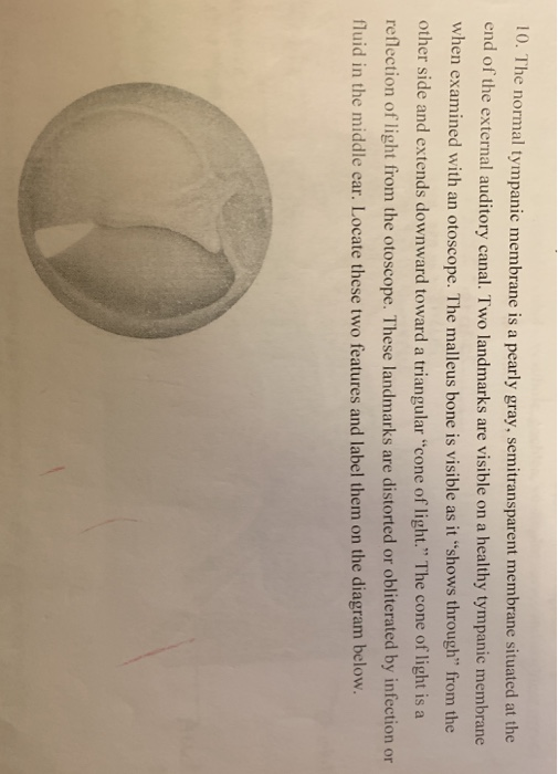 Solved 10. The normal tympanic membrane is a pearly gray, | Chegg.com