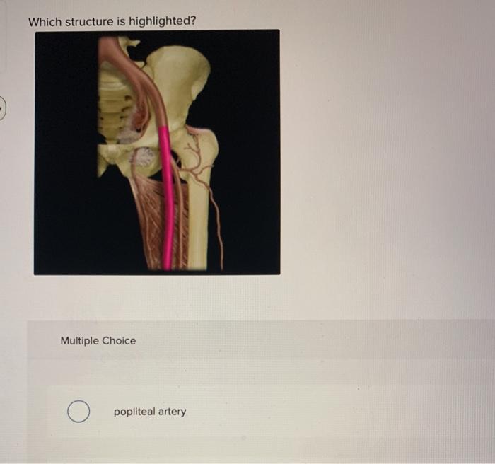 Solved Which structure is highlighted? Multiple Choice | Chegg.com