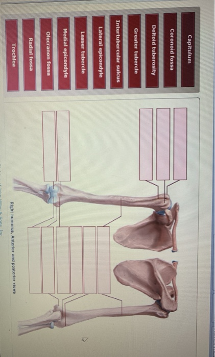 Solved Acromion Coracoid process Glenoid cavity Infraspinous | Chegg.com
