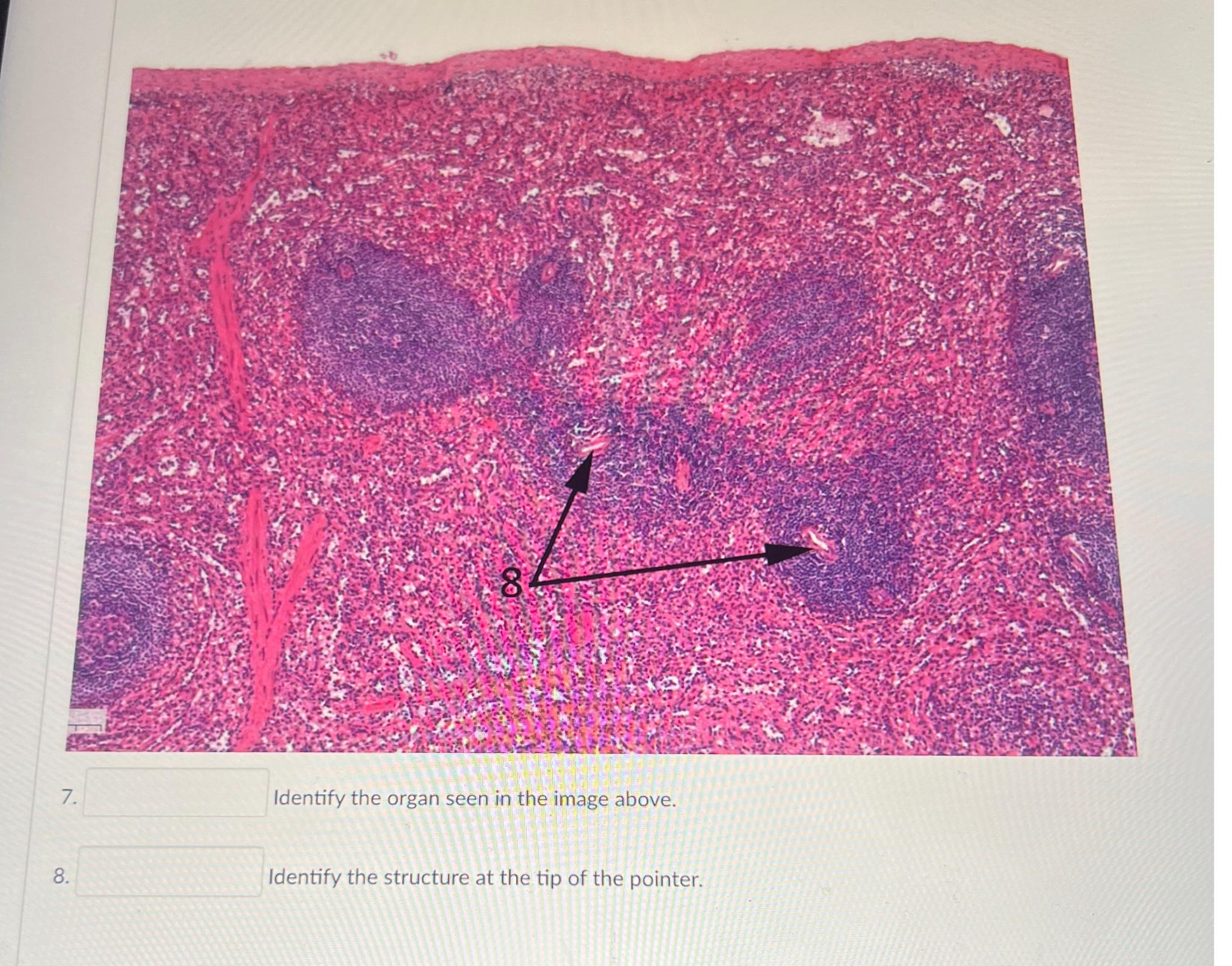 Solved Identify the organ seen in the image above.Identify | Chegg.com