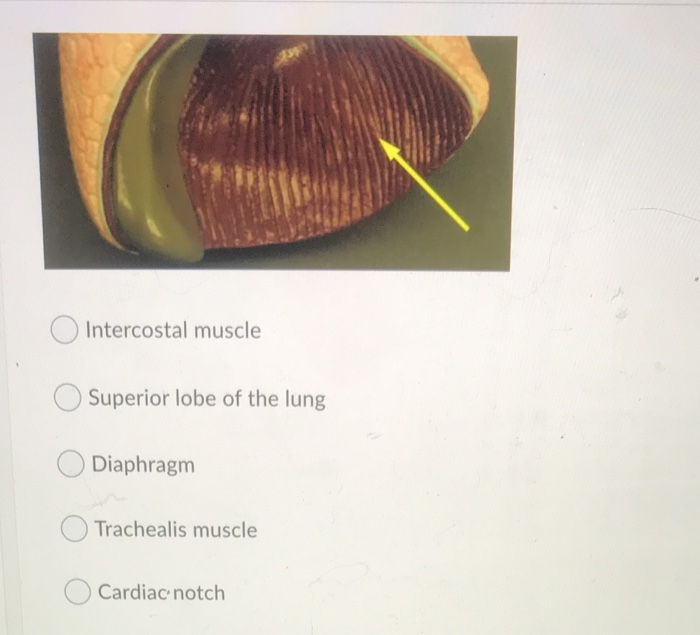 Solved 4. Identify this structure at the tip of the pointer. | Chegg.com