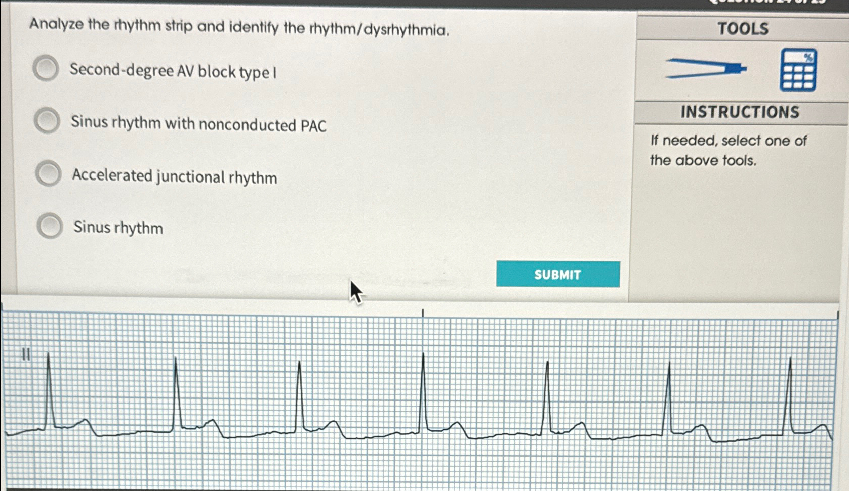 Solved Analyze the rhythm strip and identify the | Chegg.com