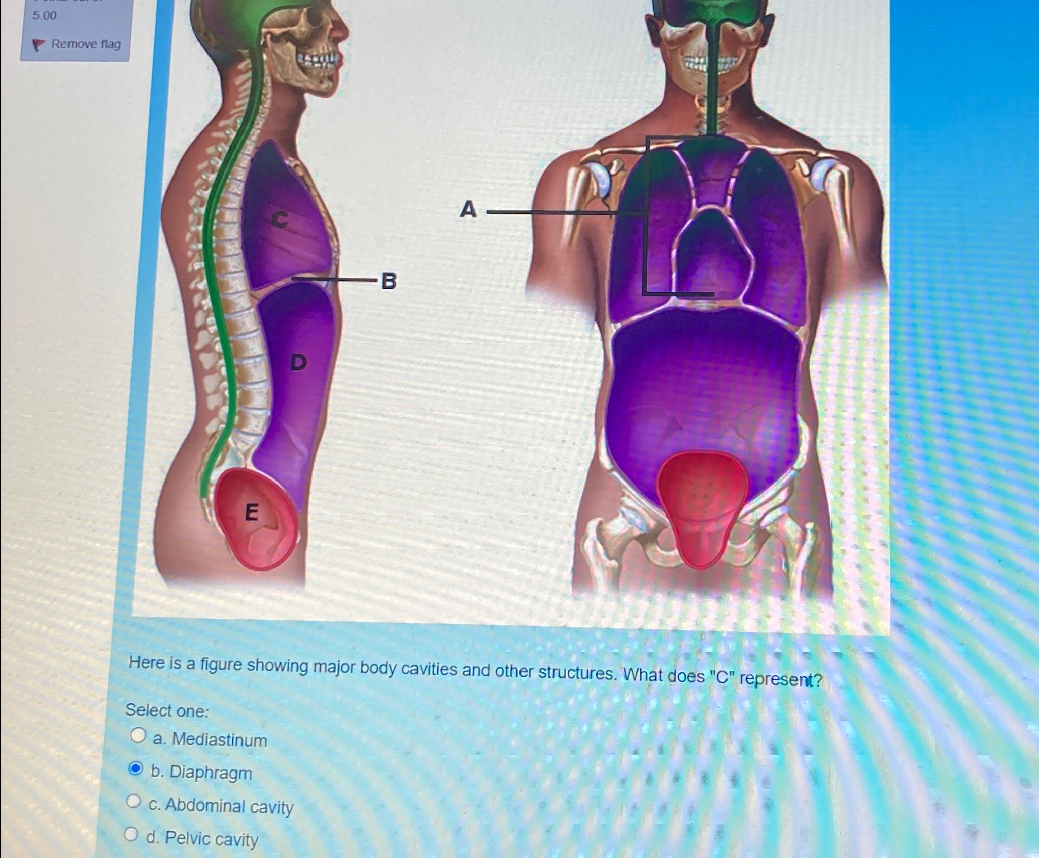 Solved Here is a figure showing major body cavities and | Chegg.com