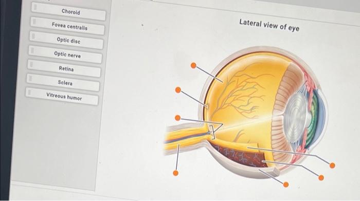 Solved Chorold Lateral view of eye Fovea centralis Optic | Chegg.com