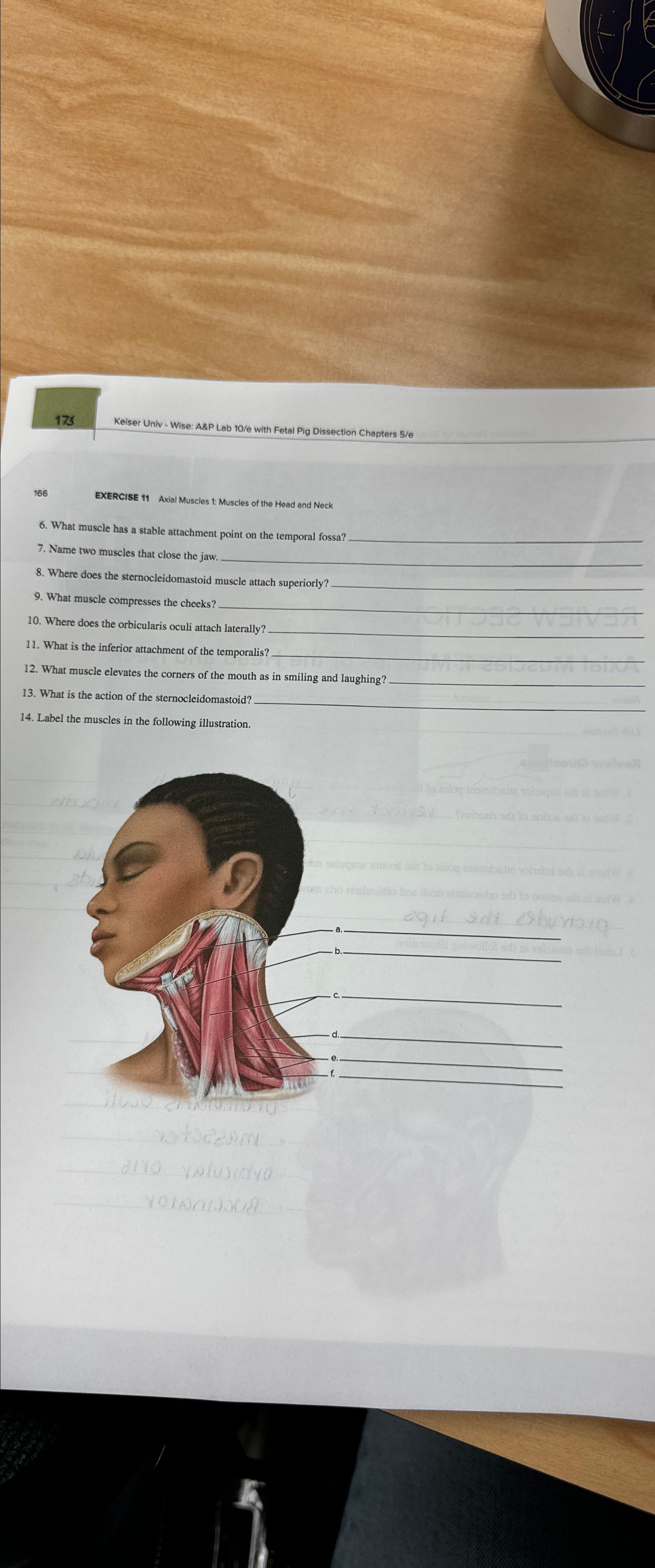 Solved 166 ﻿EXERCISE 11 ﻿Axial Muscles 1: Muscles of the | Chegg.com