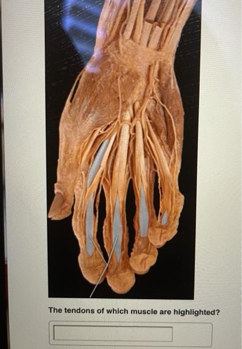 Solved Identify the highlighted muscle. The highlighted | Chegg.com Solved Identify the highlighted muscle. The highlighted | Chegg.com