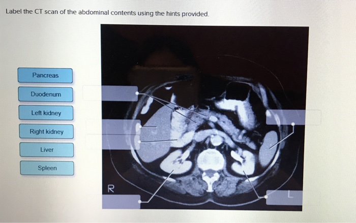Solved Label the CT scan of the abdominal contents using the | Chegg.com