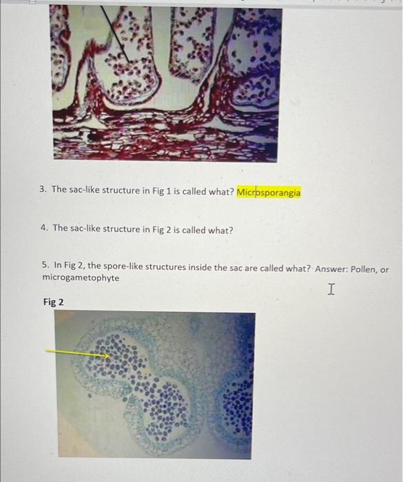 Solved 3. The sac-like structure in Fig 1 is called what? | Chegg.com