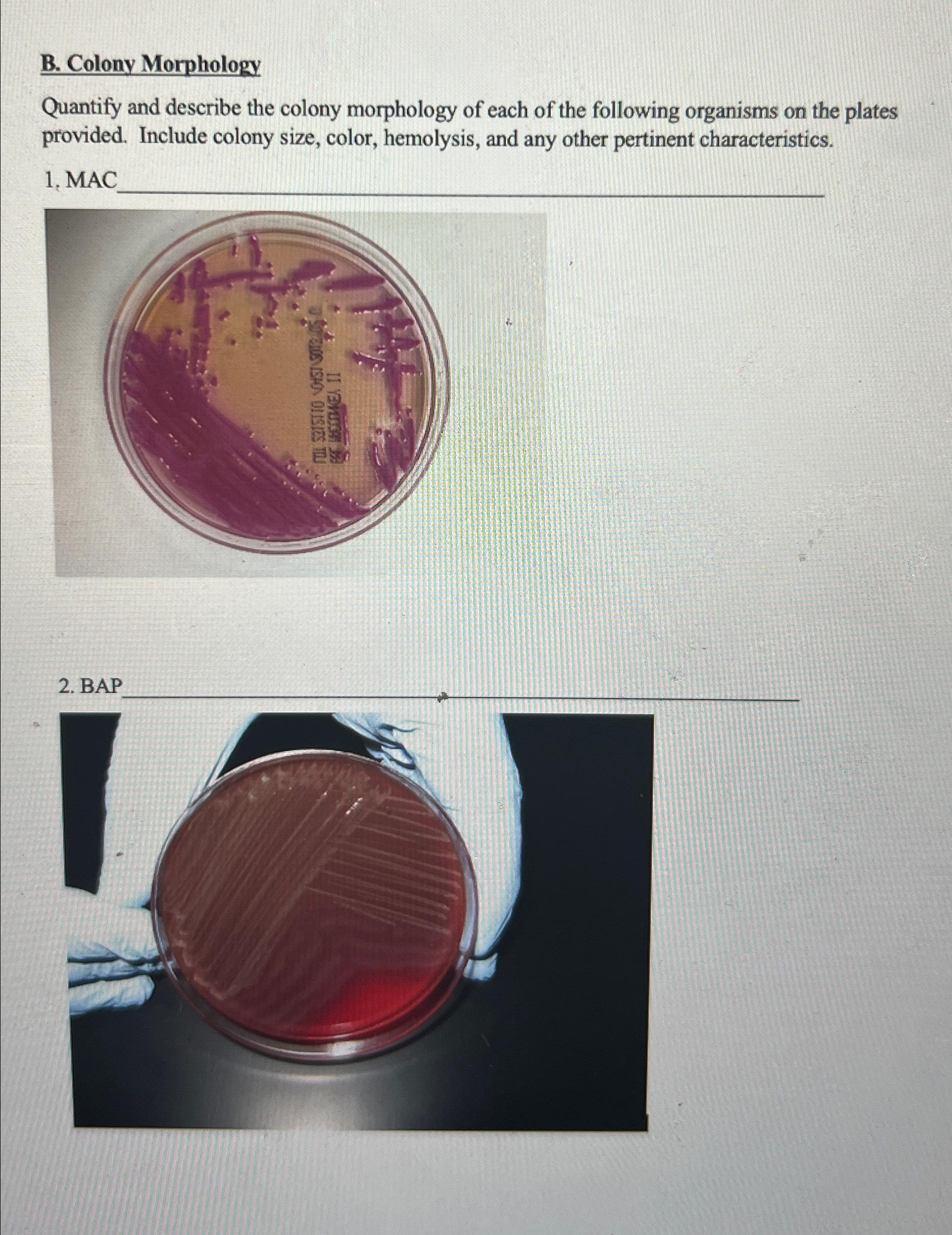 Solved B. ﻿Colony MorphologyQuantify and describe the colony | Chegg.com