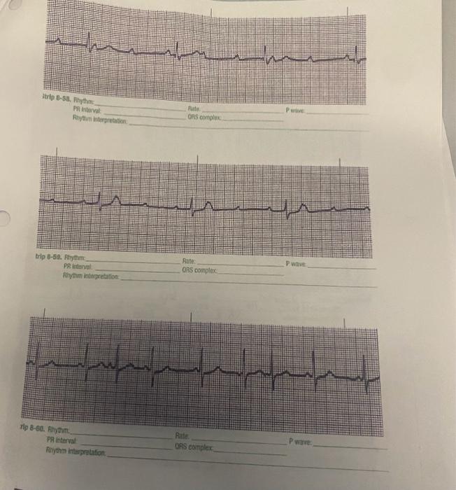 Solved Rhythm: Rate: PR Interval: a.s Complex: Rhythm | Chegg.com