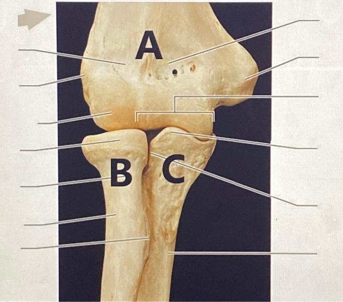 Solved name the labeled bones | Chegg.com