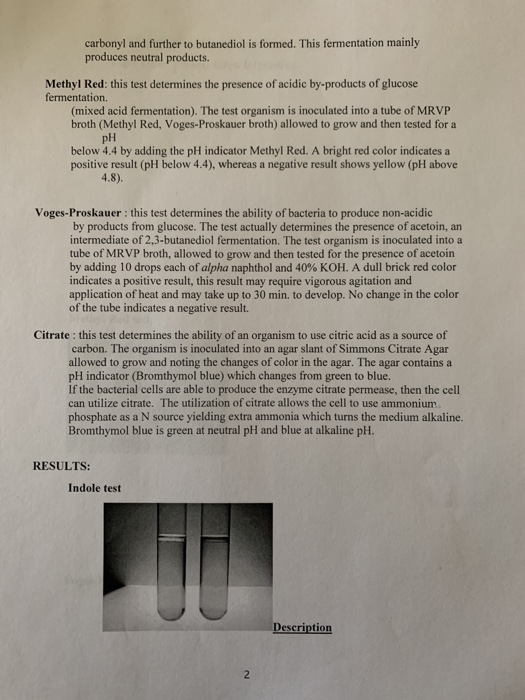 Solved . Lab # 17: IMVIC The IMViC is a series of four tests | Chegg.com