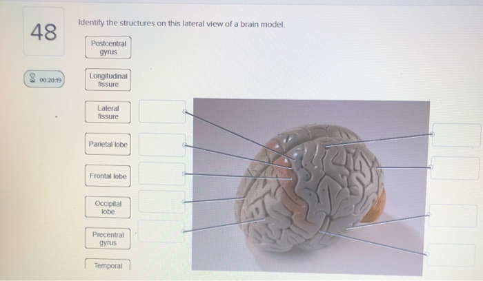 Solved Identify the structures on this lateral view of a | Chegg.com