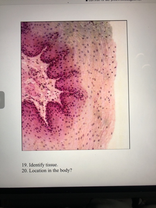 Solved 19. Identify tissue. 20. Location in the body? | Chegg.com