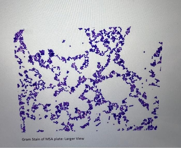 Solved Unknown sample number: 5 1. TSA plate gram stain | Chegg.com