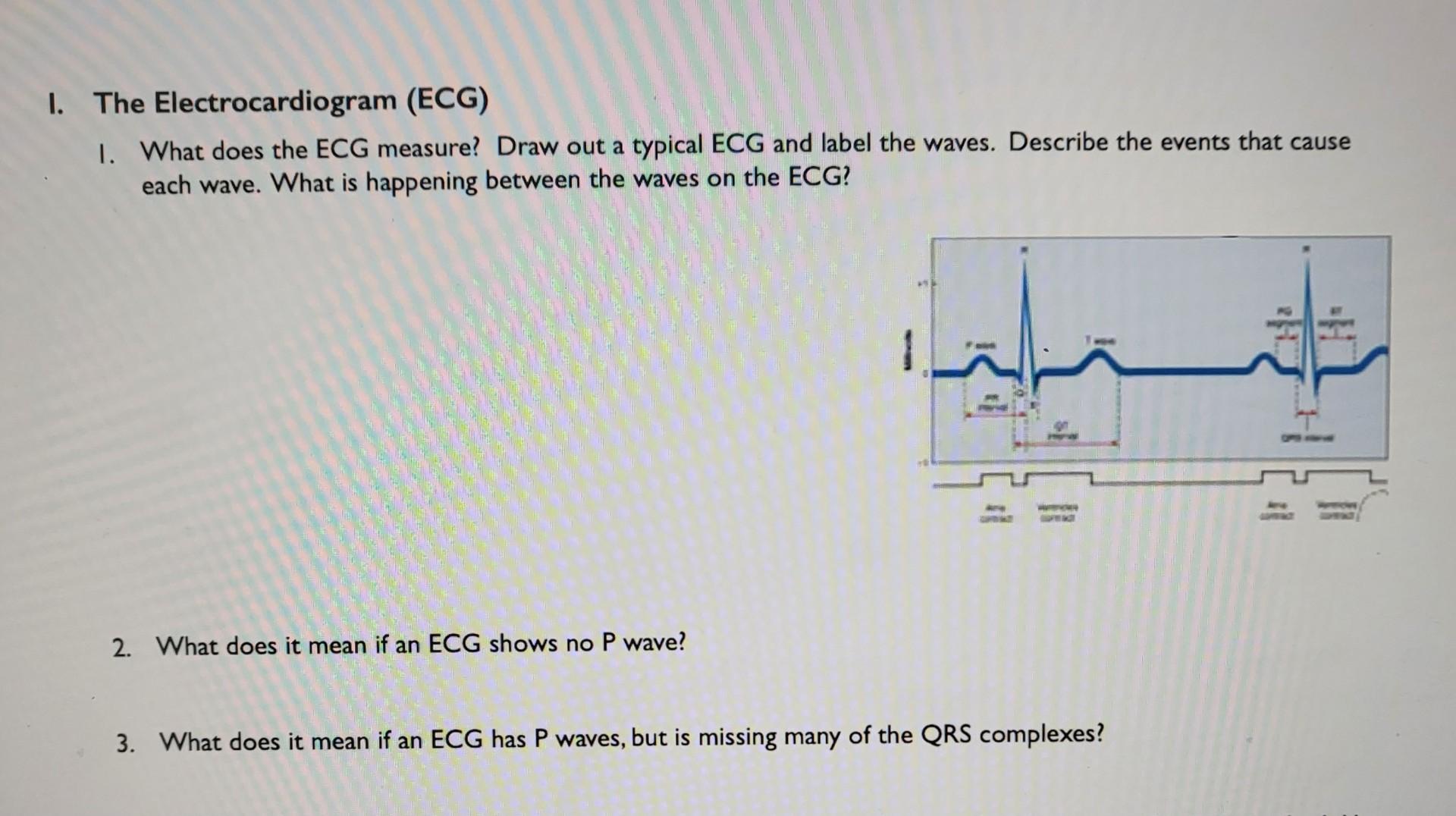 Solved The Electrocardiogram (ECG) I. What does the ECG | Chegg.com