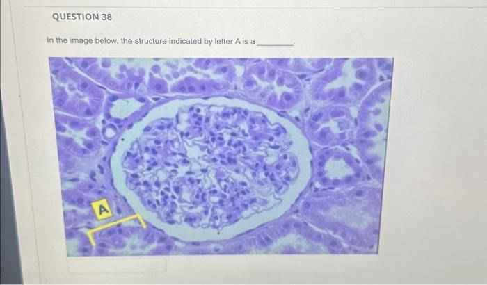 Solved In the image below, the structure indicated by letter | Chegg.com