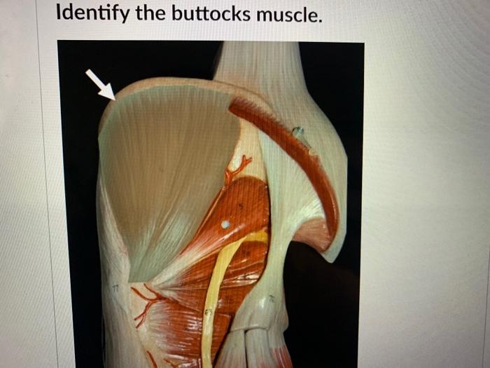 Solved Identify the buttocks muscle. | Chegg.com