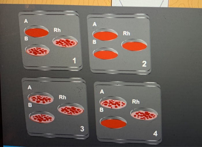 Solved 13. What wells showed clumping in each of the four | Chegg.com
