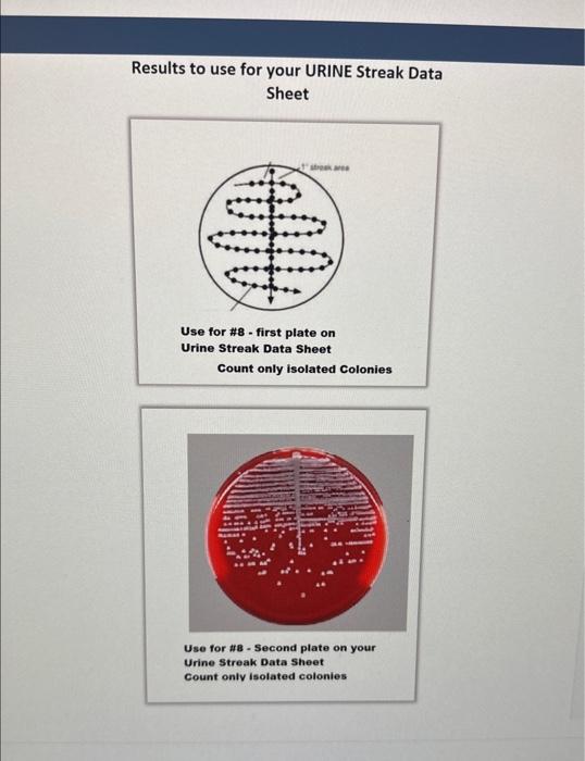Solved Urine Culture OBSERVATIONS AND INTERPRETATIONS 1 | Chegg.com