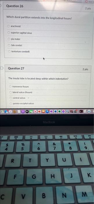 Solved Question 26 2 pts Which dural partition extends into | Chegg.com