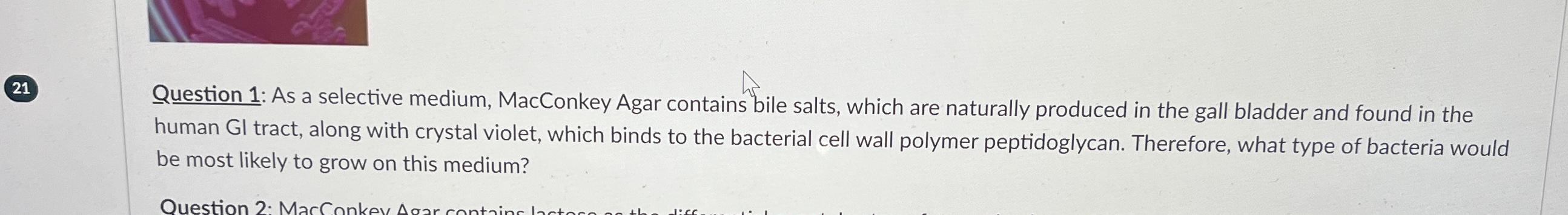 Solved Question 1: As a selective medium, MacConkey Agar | Chegg.com