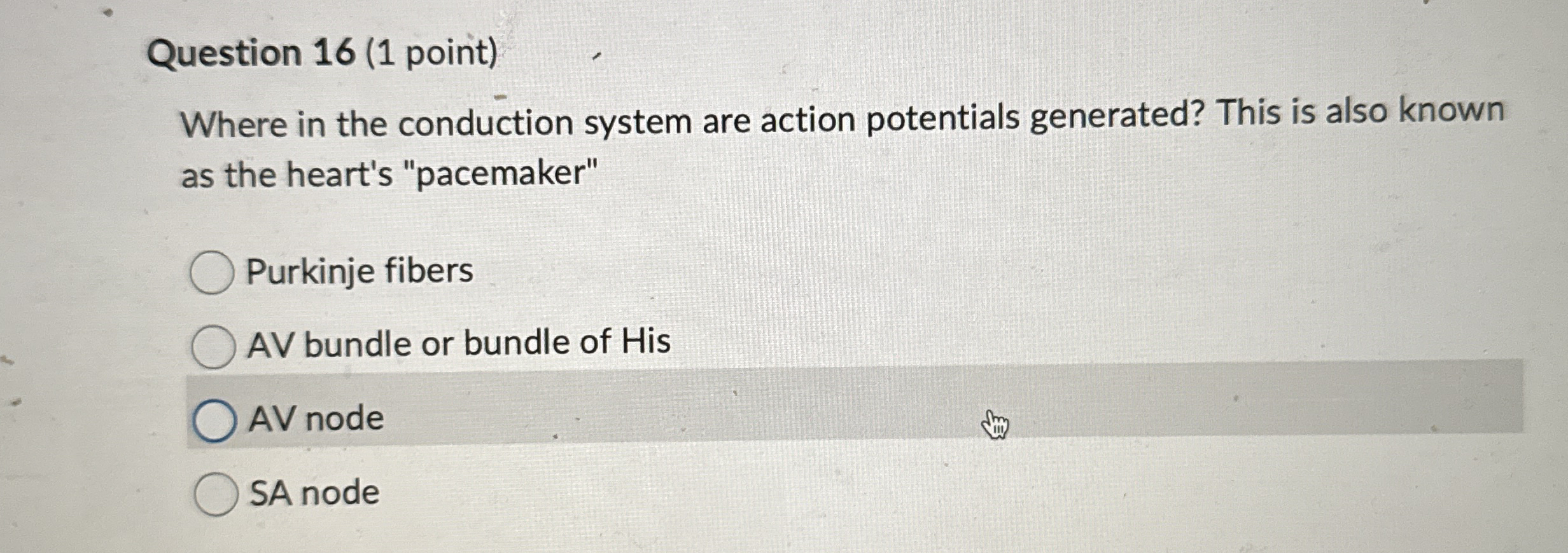 Solved Question 16 (1 ﻿point)Where in the conduction system | Chegg.com