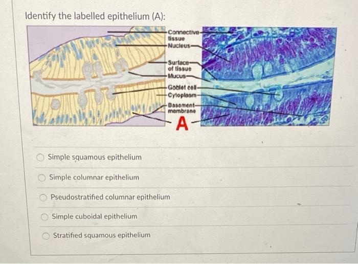 Solved Identify the labelled epithelium (A): Simple cuboidal | Chegg.com