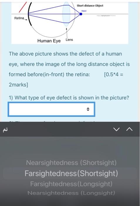 Solved Short distance Object Retina Human Eye Lens The above | Chegg.com