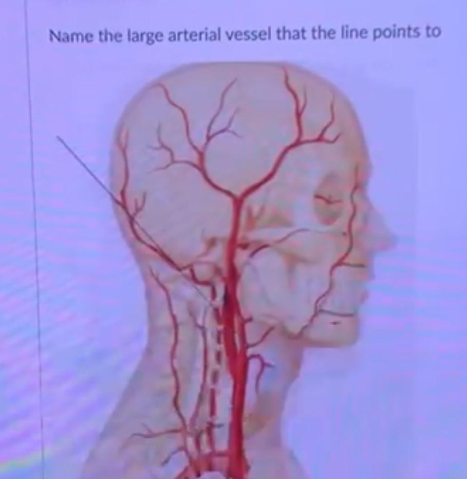 Solved Name the large arterial vessel that the line points | Chegg.com