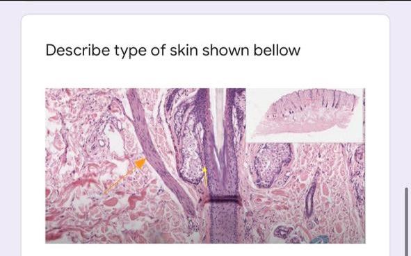 Solved Describe type of skin shown bellow თქვენი პასუხი | Chegg.com