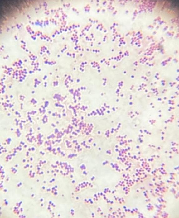 Solved Cell arrangement and bacteria? characteristic: G+, | Chegg.com