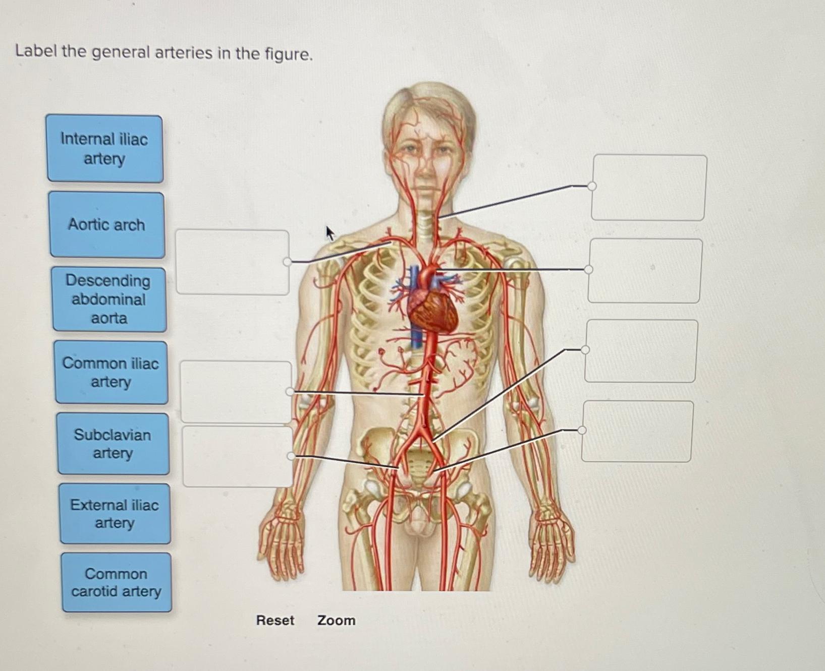 Solved Label the general arteries in the figure. | Chegg.com