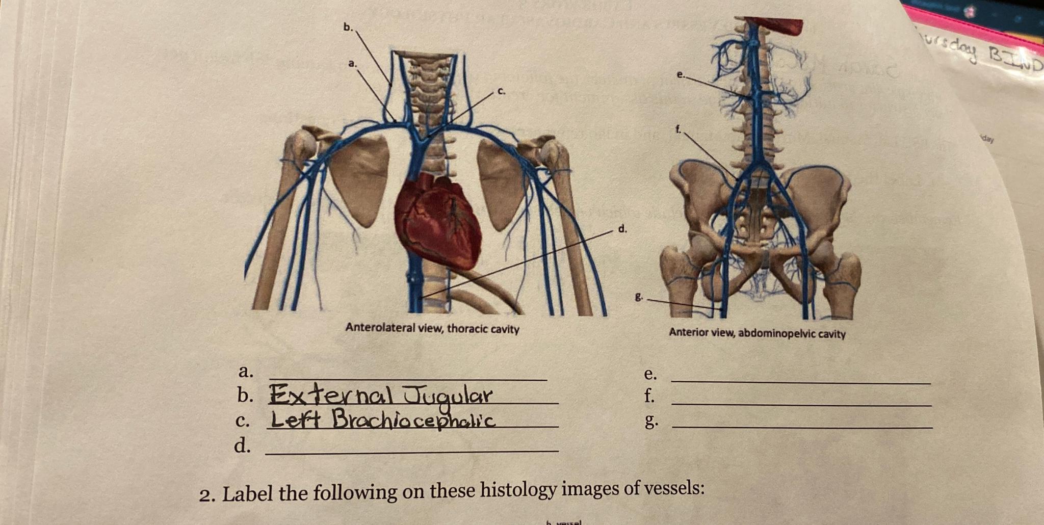 Solved Anterolateral view, thoracic cavitya.b. ﻿External | Chegg.com