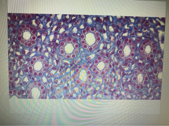 Solved Page v 3 > of 64 o Slide 1: Kidney Identify: • Simple | Chegg.com