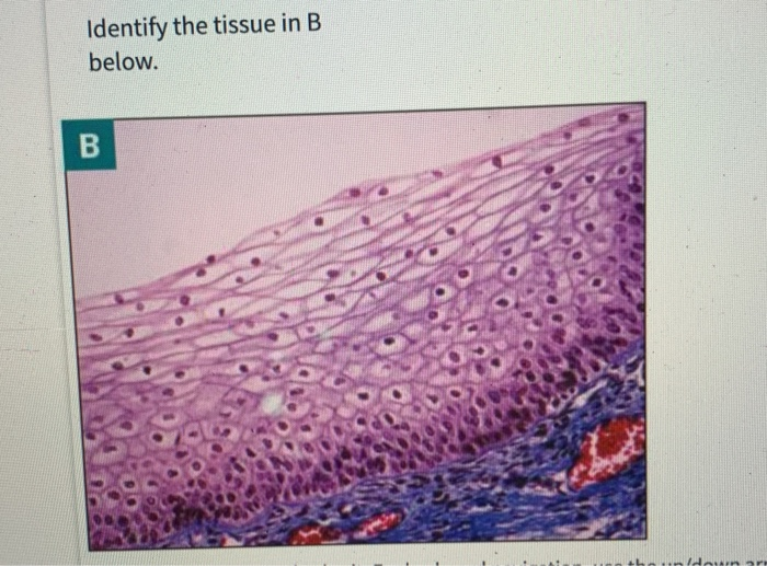 Solved Identify the tissue in A below. A Identify the | Chegg.com