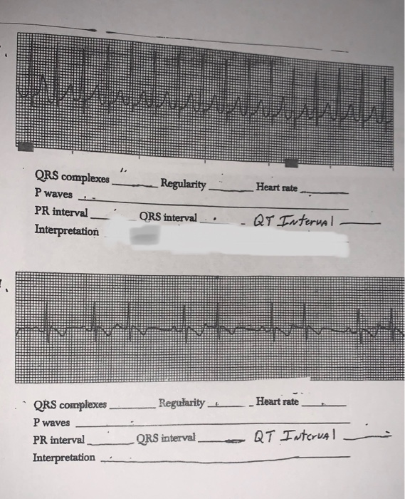 WWWAAAA Regularity Heart rate QRS complexes P waves | Chegg.com