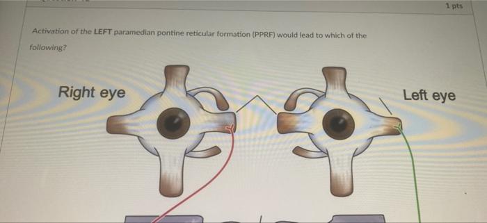 Solved 1 pts Activation of the LEFT paramedian pontine | Chegg.com