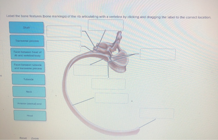 Solved Label the bone features (bone markings) of the rib | Chegg.com