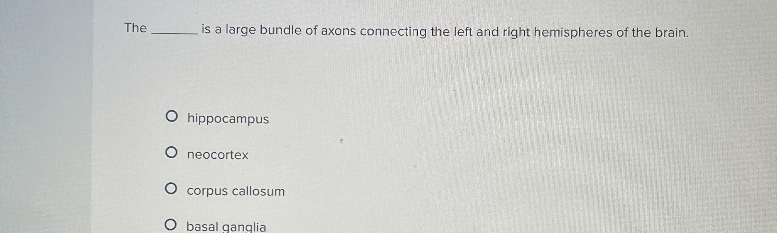 Solved Theis a large bundle of axons connecting the left and | Chegg.com