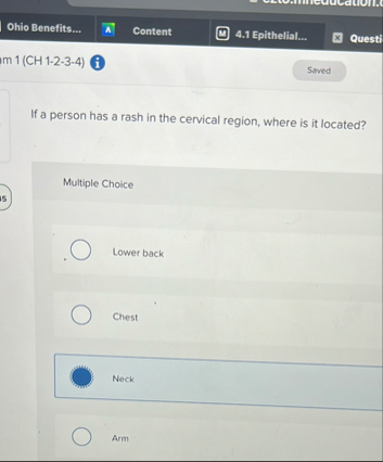 Solved Ohio Benefits...λContent4.1 ﻿Epithelial...Quest:Im | Chegg.com