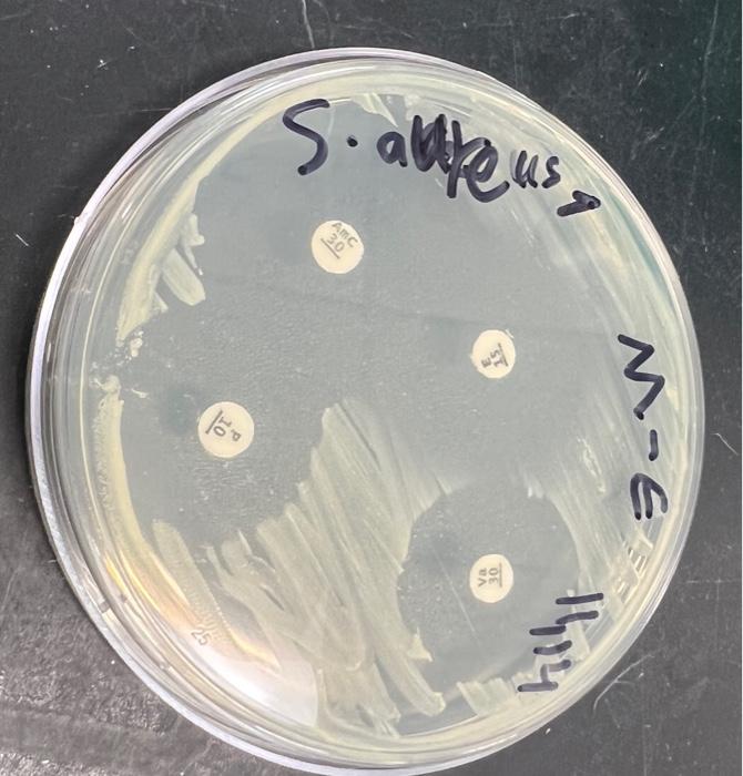 Solved 1)Do you see any small colonies within the zones of | Chegg.com