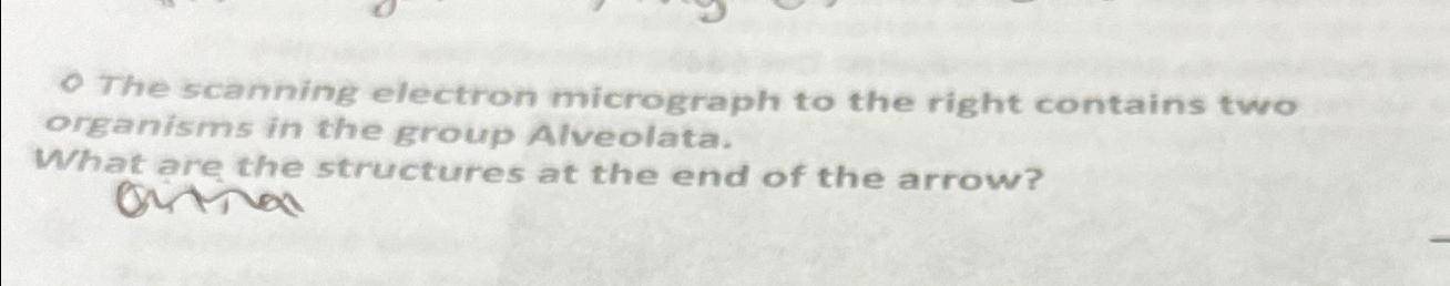 Solved The scanning electron micrograph to the right | Chegg.com