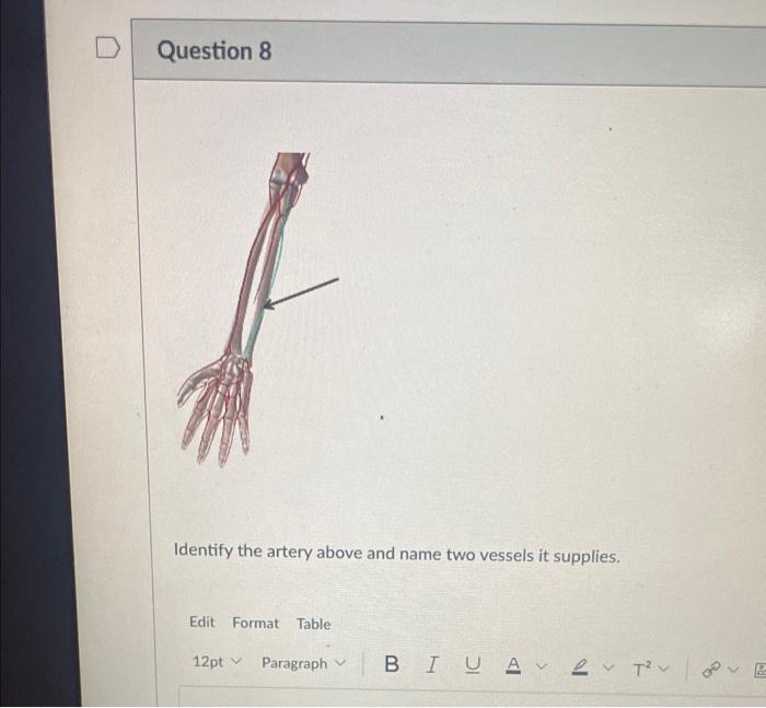 Solved Identify the artery above and name two vessels it | Chegg.com
