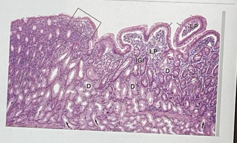 Solved Whats is this junction?A. ﻿Stomach and duodenumB. | Chegg.com
