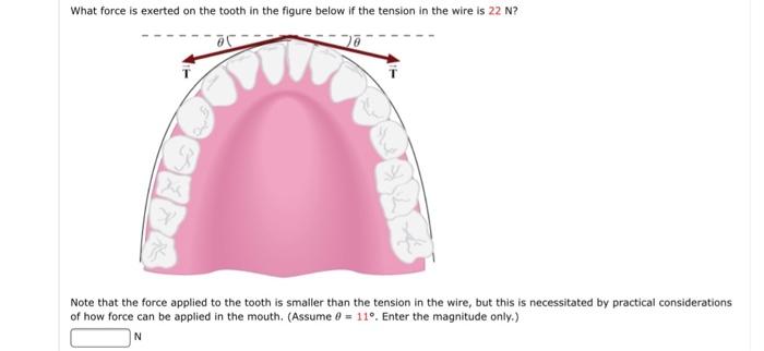 Solved What force is exerted on the tooth in the figure | Chegg.com