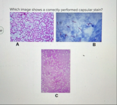 Solved Which image shows a correctly performed capsular | Chegg.com