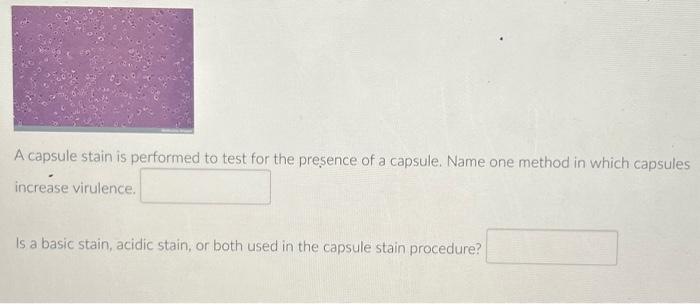 Solved A capsule stain is performed to test for the presence | Chegg.com